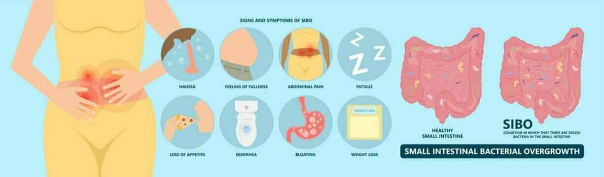 Prise en charge du sibo | Blog