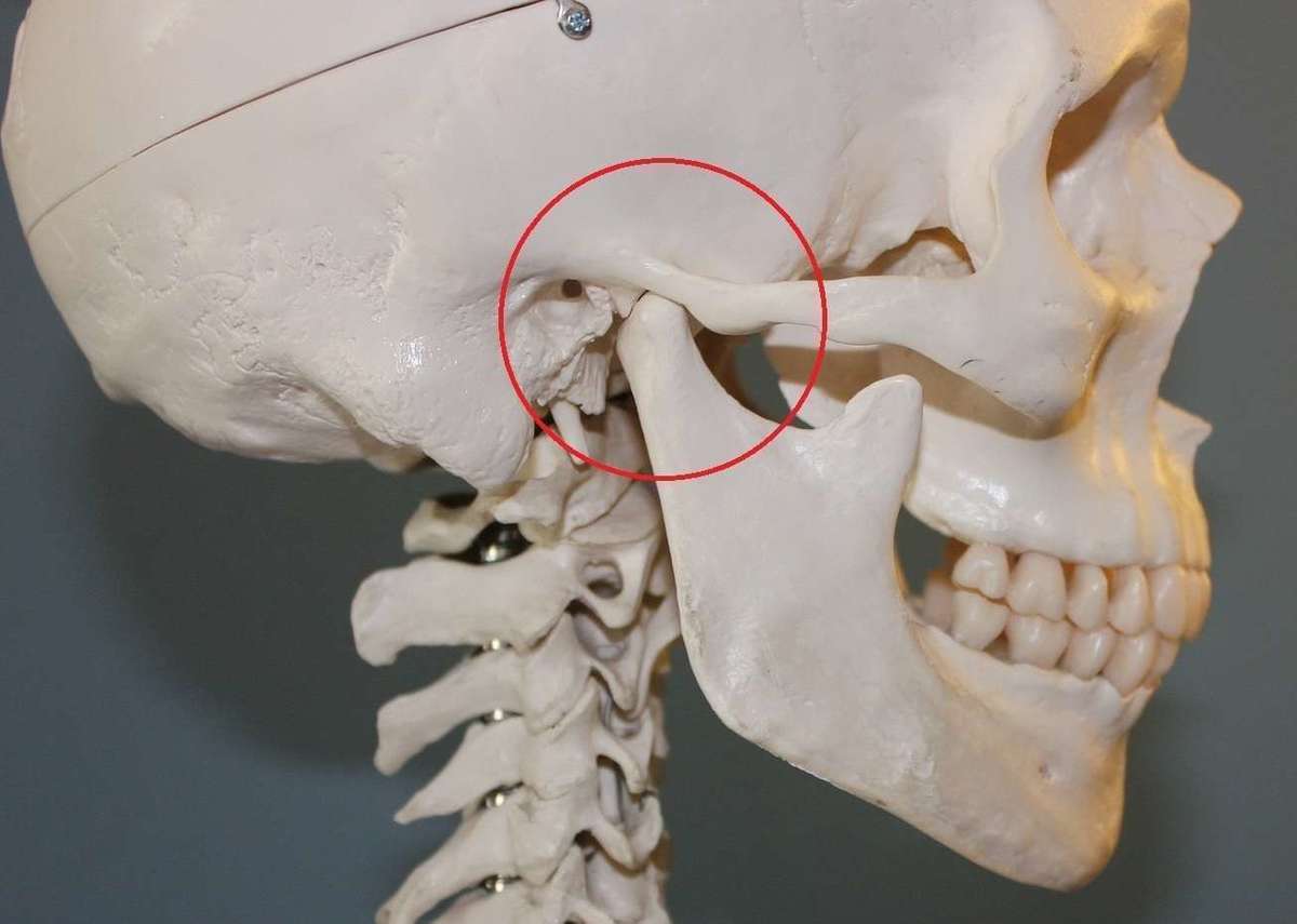 3 choses à savoir sur les douleurs de la mâchoire | Blog