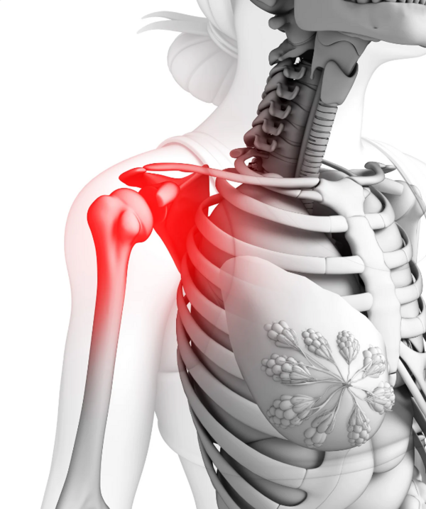 Le slap syndrome, tout ce qu’il faut savoir | Actualités