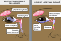 Canal Lacrymal et ostéopathie | Blog