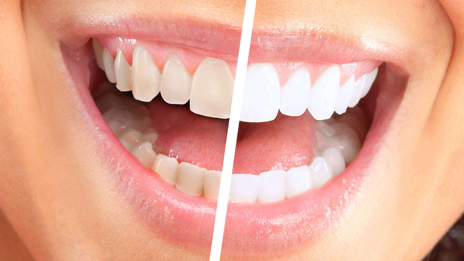 Chirurgien-dentiste Paris 15 – Dr Marc Olivier Faboumy