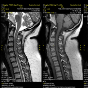 IRM Rachidienne | IRM CHARENTON