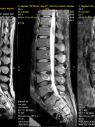 IRM Rachidienne | IRM CHARENTON