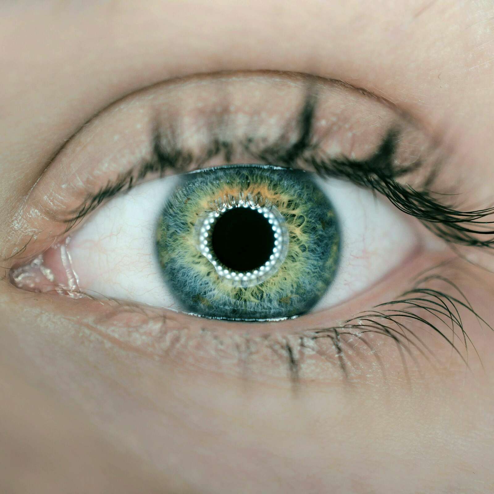 Clinique Ophtalmologique Thiers Bordeaux Chirurgie Cataracte Glaucome