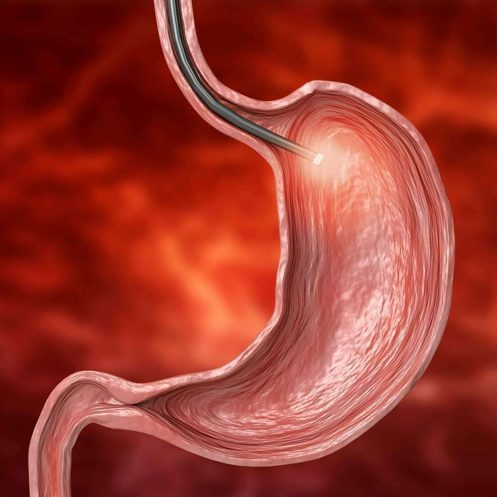 L'estomac, étape cruciale de la digestion | Blog