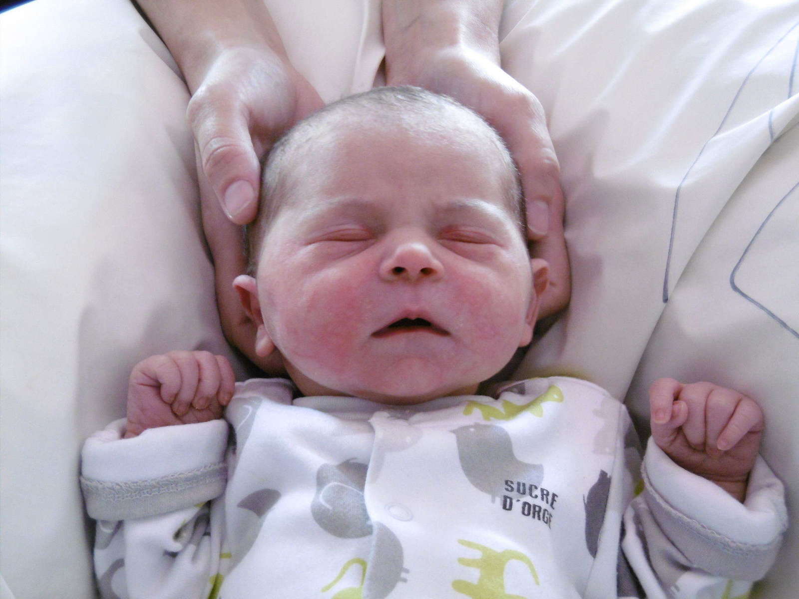 Aplatissement du crâne de bébé | Blog