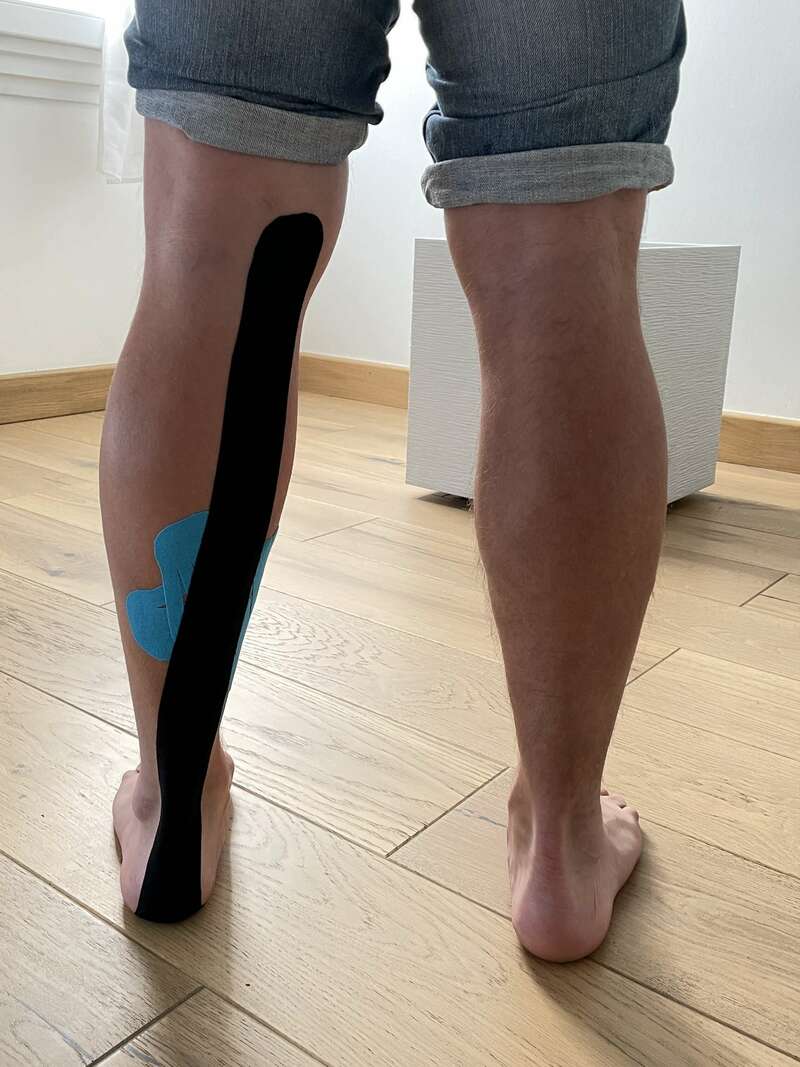 Tennis leg et ostéopathie | Blog