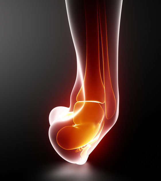 Comment réagir en cas d'entorse | Blog