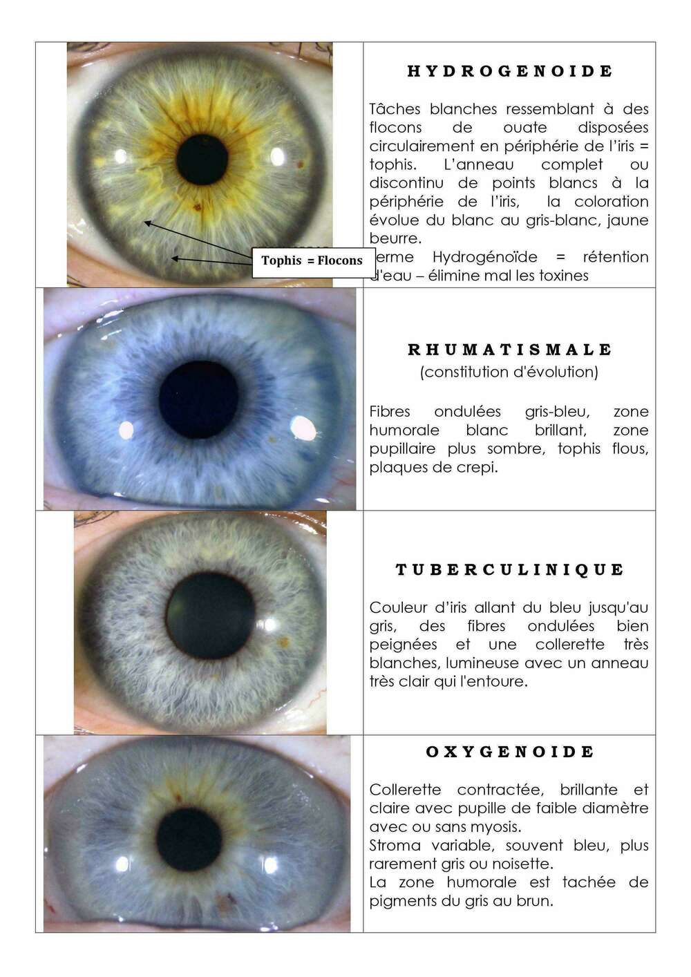 Formation Iridologie à Lardy (91510)