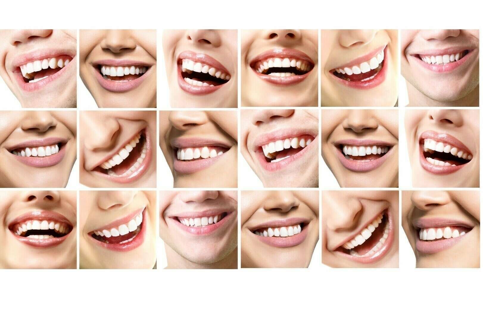 Orthodontie Adulte Sceaux - Drs Bogey, Nief et Wang Orthodontie Adulte Sceaux - Drs Bogey, Nief et Wang