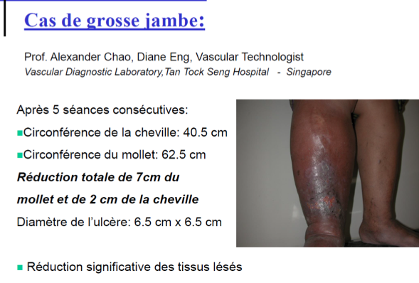 Séances de Diaveine en cabinet à Toulouse (31000)