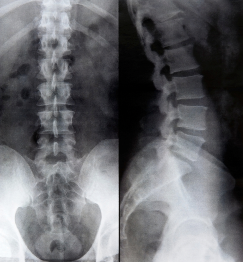 Cruralgia and osteopathy | Blog